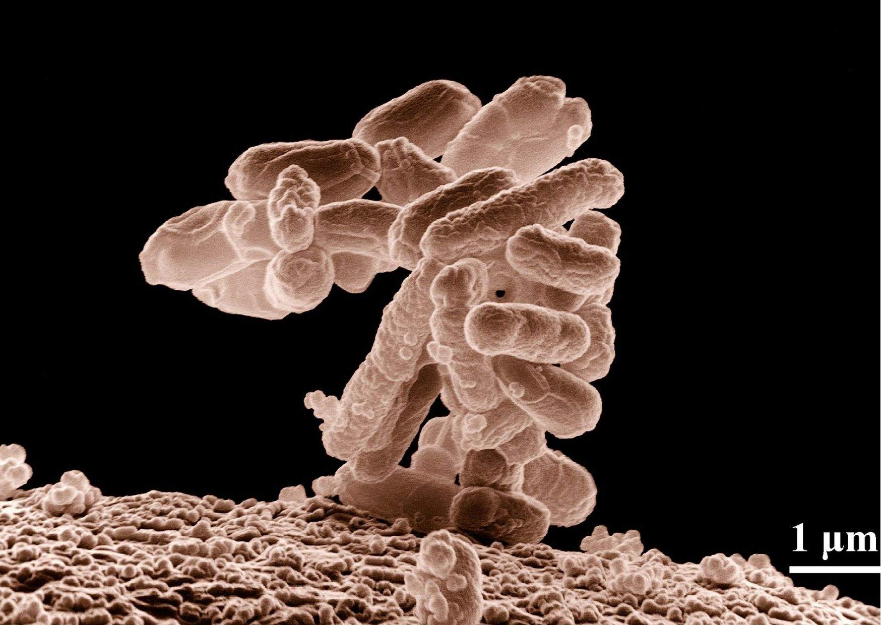 What Are the Most Common Bacterial Infections in Humans?